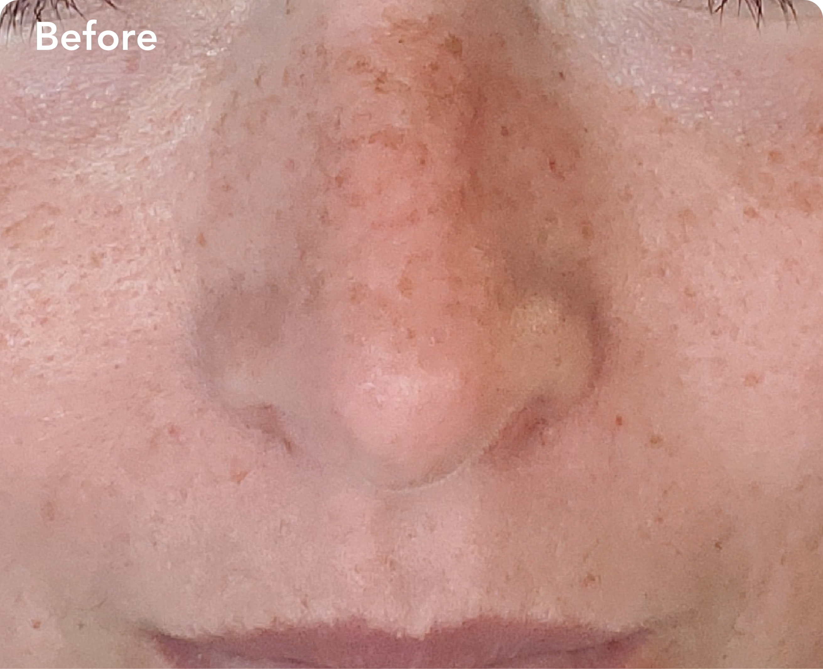 The Corrector V2 from Riversol | Targets hyperpigmentation, dark spots ...