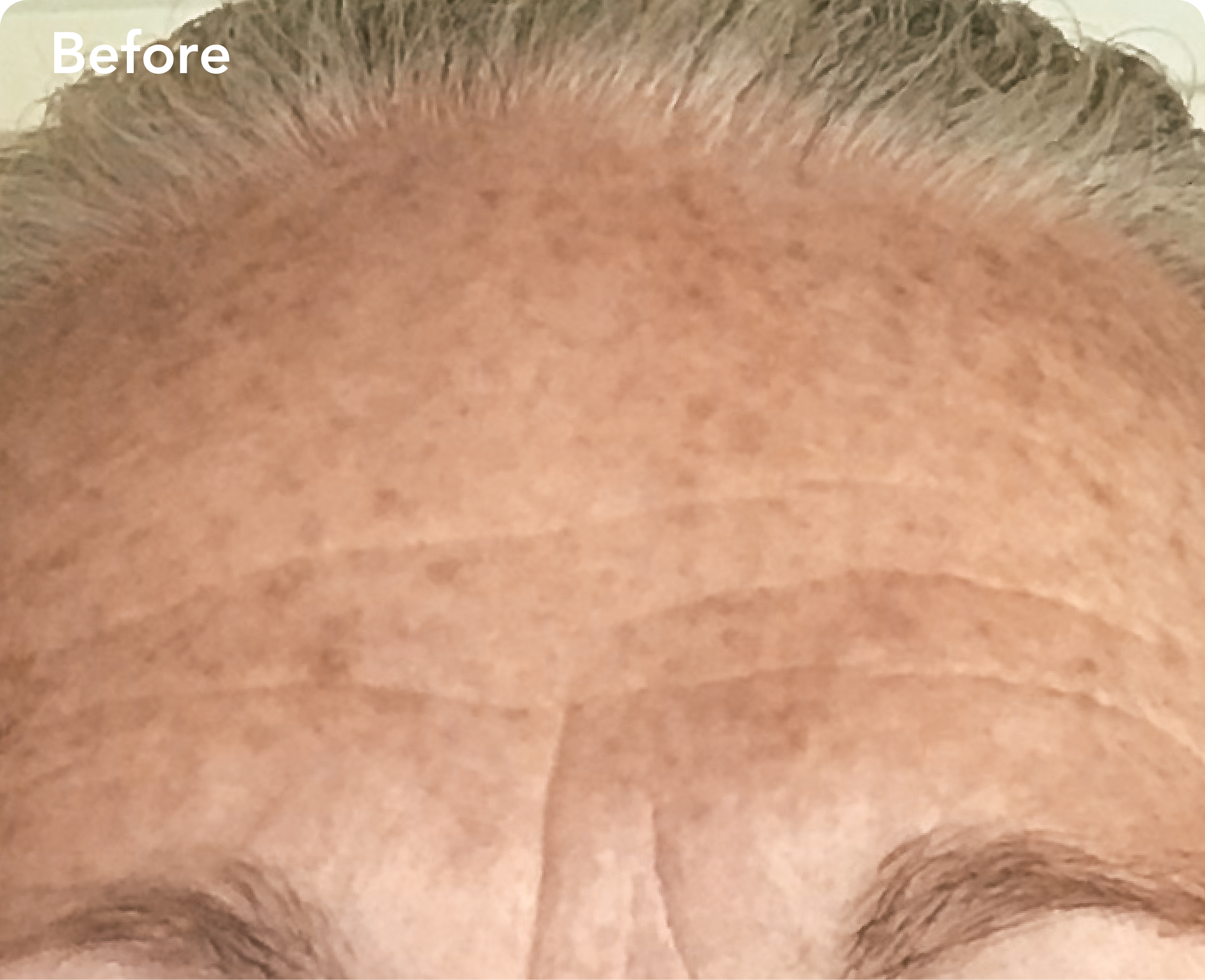 The Corrector V2 from Riversol | Targets hyperpigmentation, dark spots ...