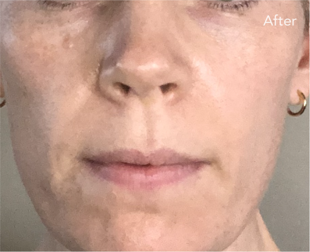 Riversol 0.5% Retinol - Reduce Fine Lines & Dark Spots | Vitamin C ...