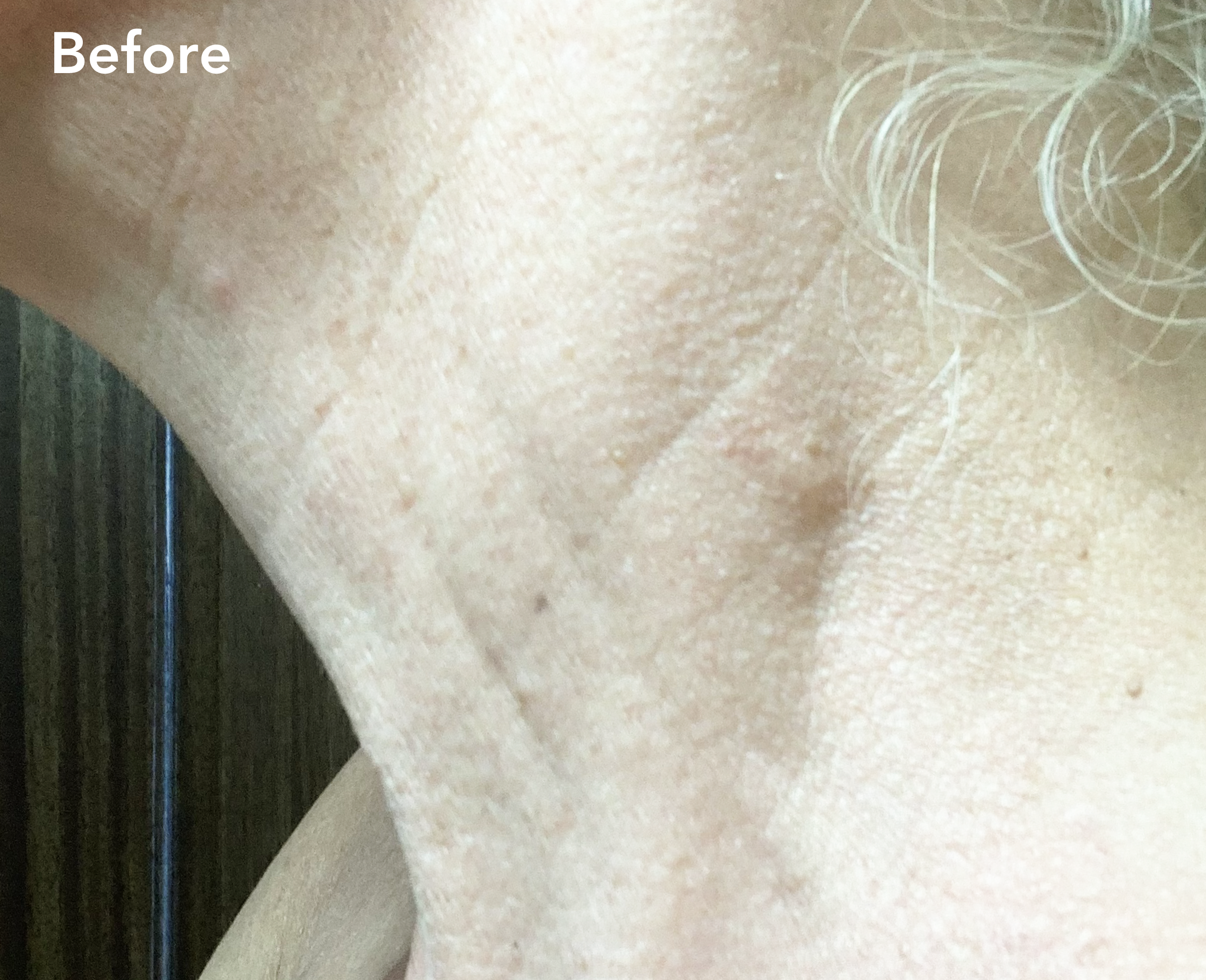 Retinol Neck Cream with 0.10% pure retinol and peptides - 50ml | Riversol