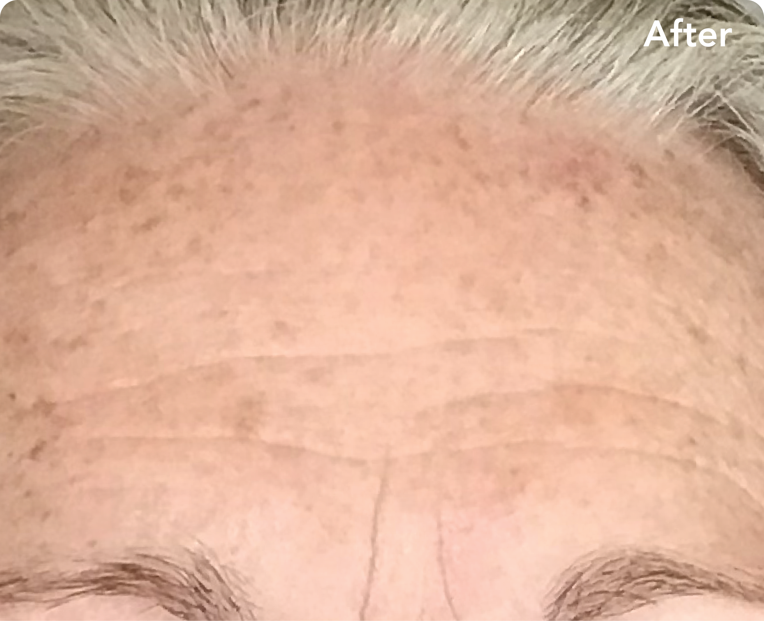 The Corrector V2 from Riversol | Targets hyperpigmentation, dark spots ...