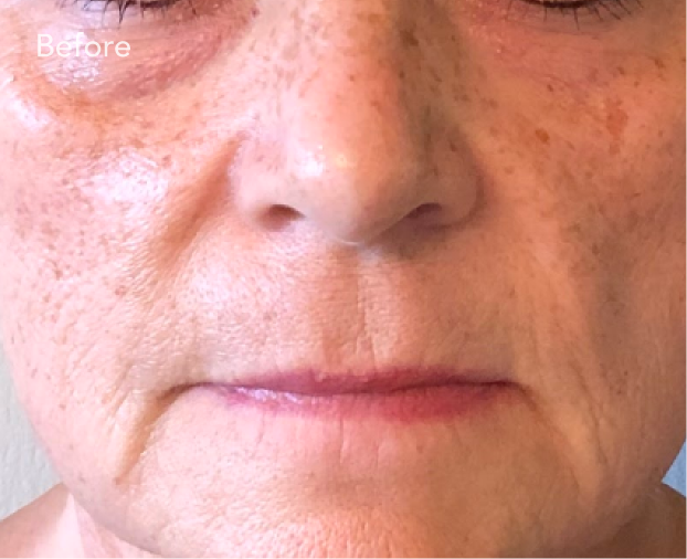 Riversol 0.5% Retinol - Reduce Fine Lines & Dark Spots | Vitamin C ...